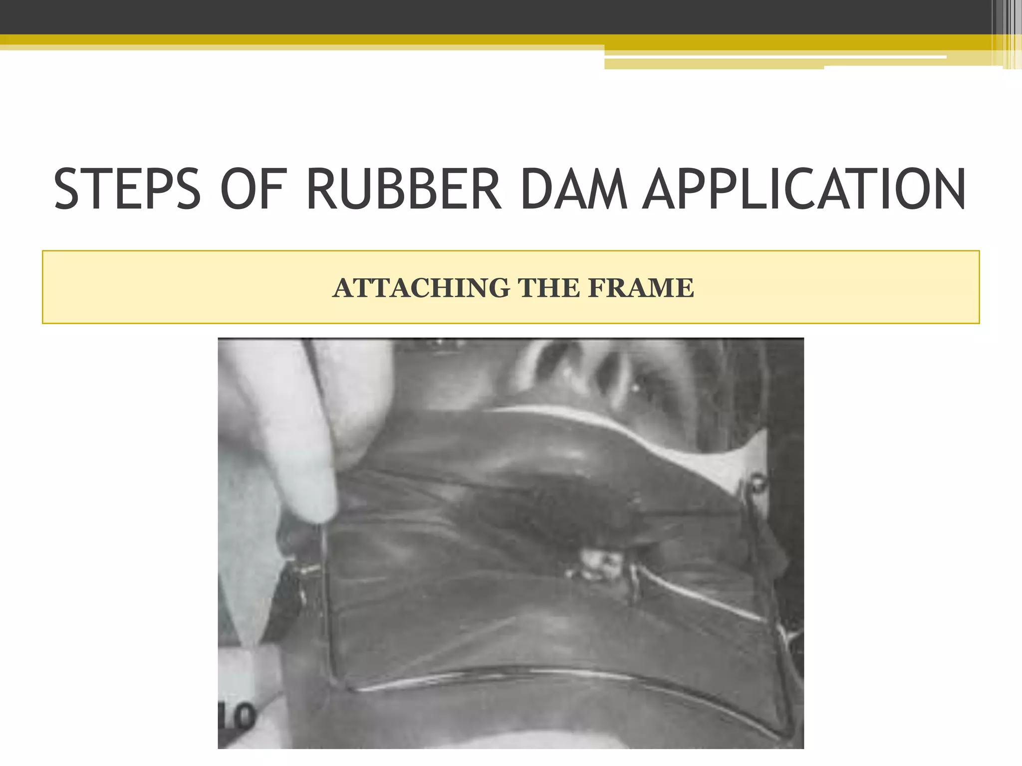 Isolation: The Rubber Dam | PPTX