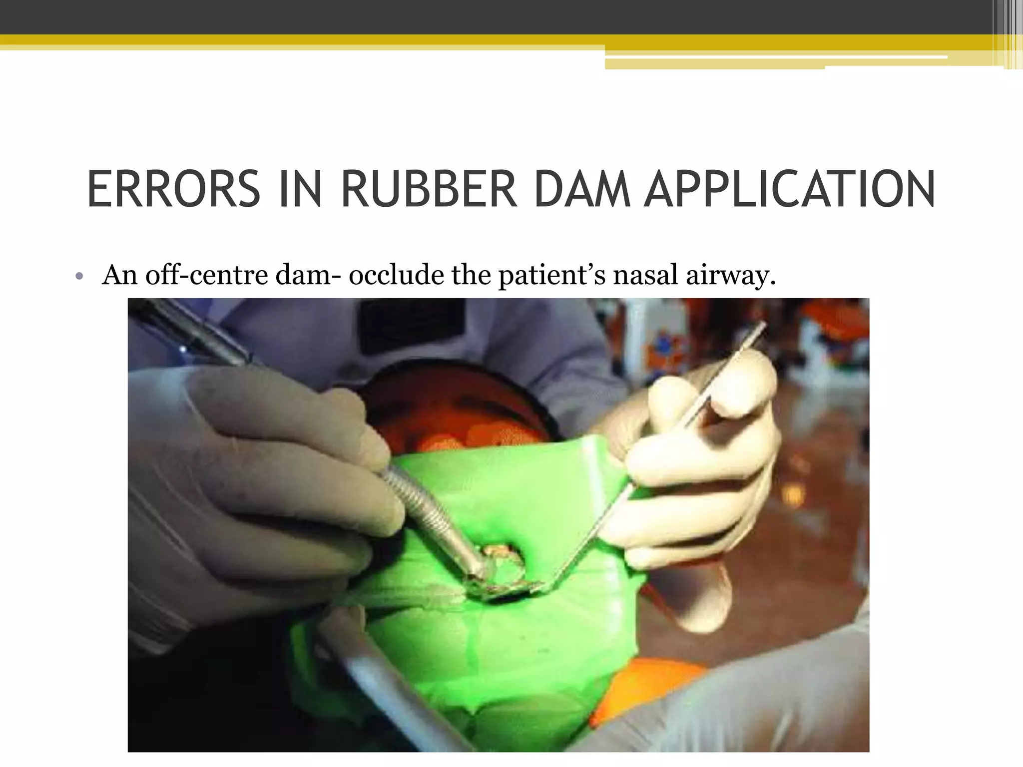 Isolation: The Rubber Dam | PPTX