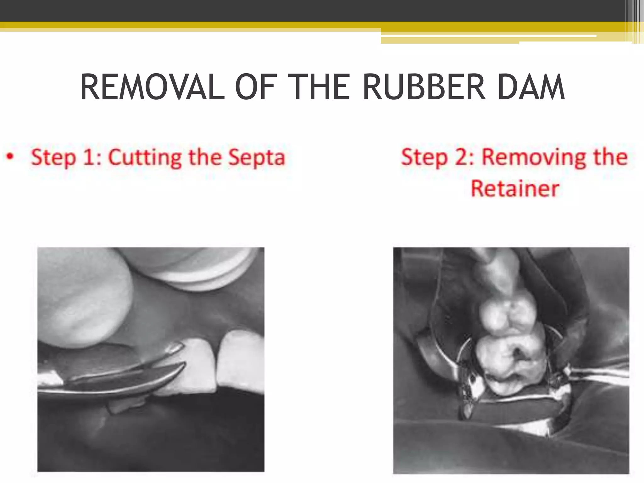 Isolation: The Rubber Dam | PPTX
