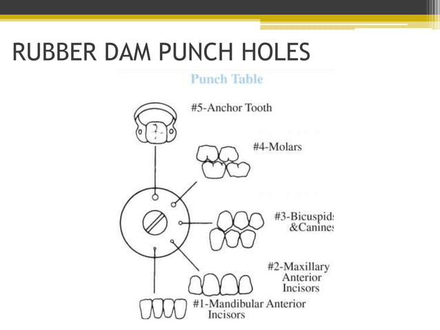 Isolation: The Rubber Dam | PPTX | Oral care | Personal Care