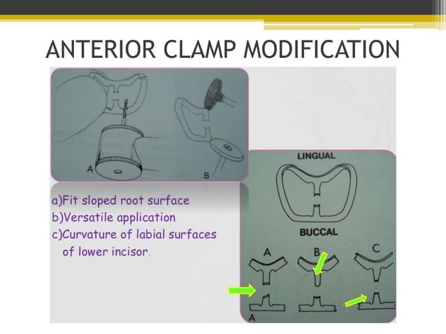 Isolation: The Rubber Dam | PPTX | Oral care | Personal Care
