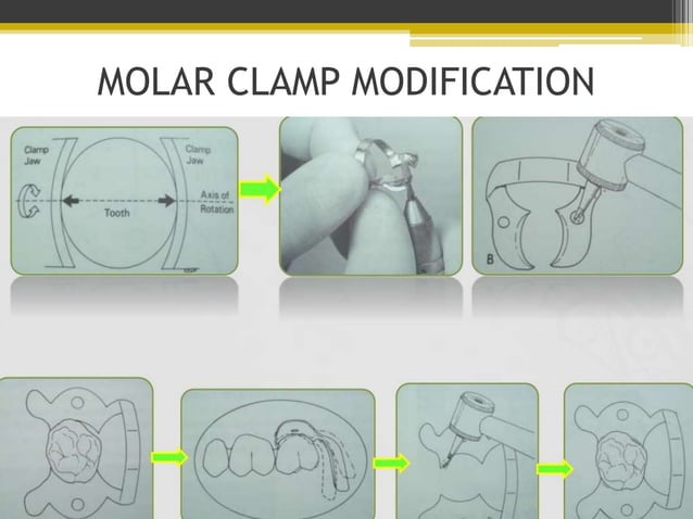 Isolation: The Rubber Dam | PPTX | Oral care | Personal Care