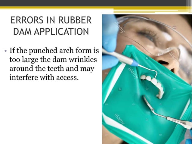Isolation: The Rubber Dam | PPT
