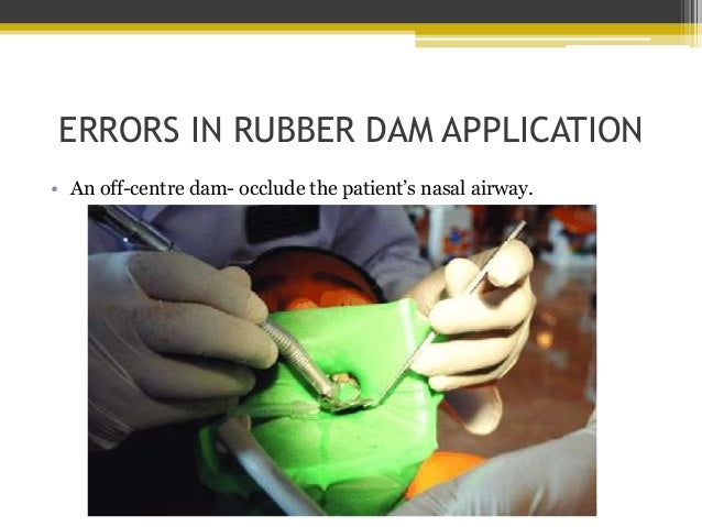 Isolation: The Rubber Dam