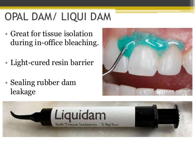 Isolation: The Rubber Dam