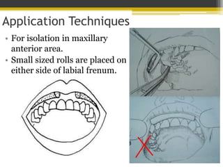 Isolation: Other Methods | PPTX