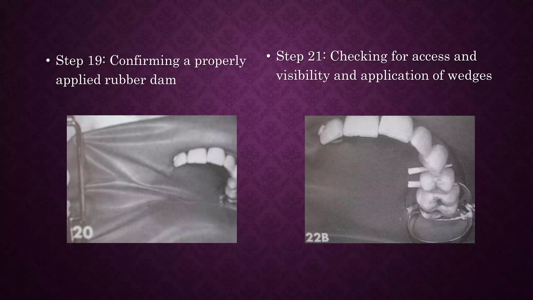 ISOLATION - Importance,Methods and Advantages | PPTX