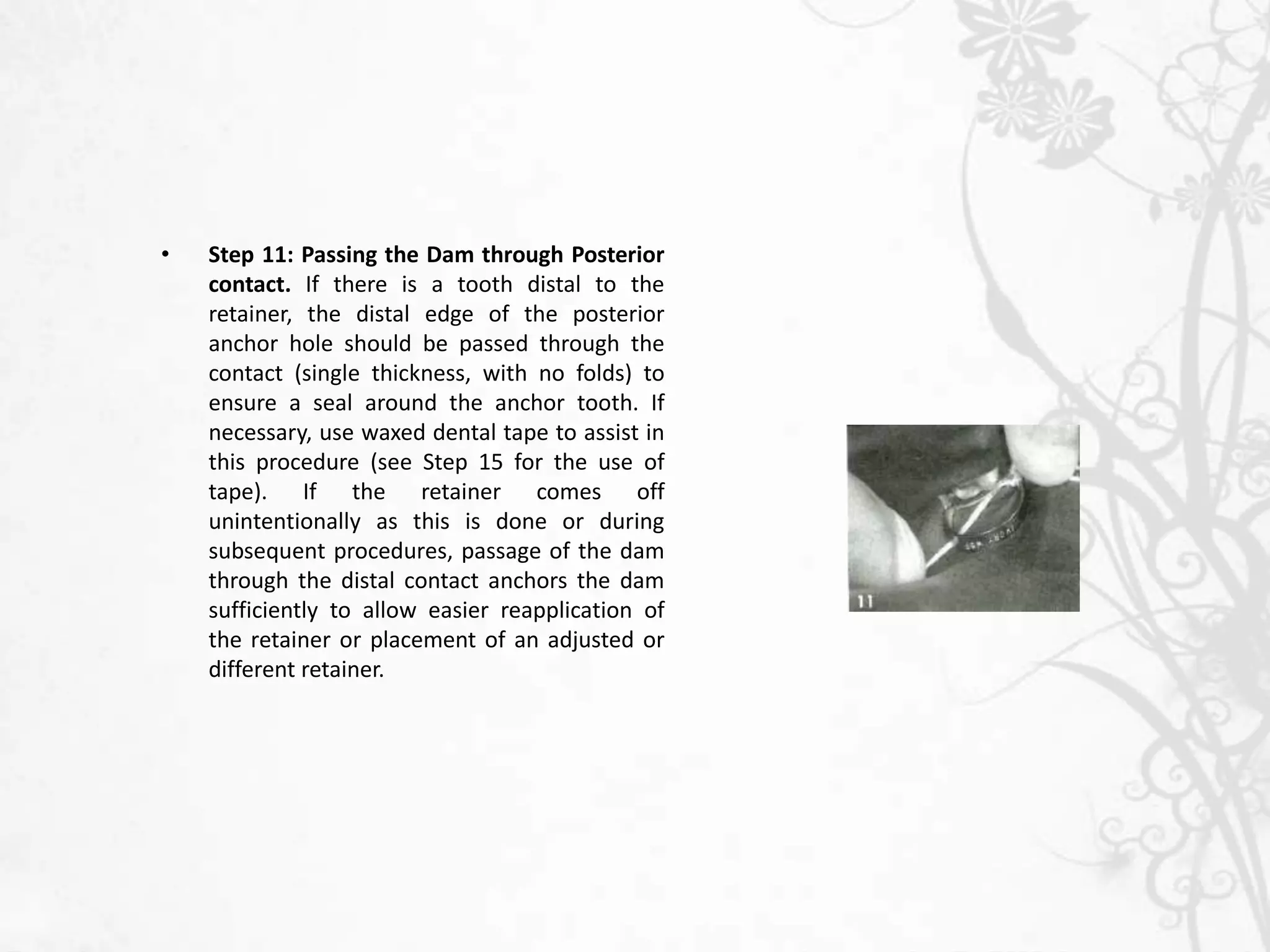 Isolation in Dentistry | PPTX