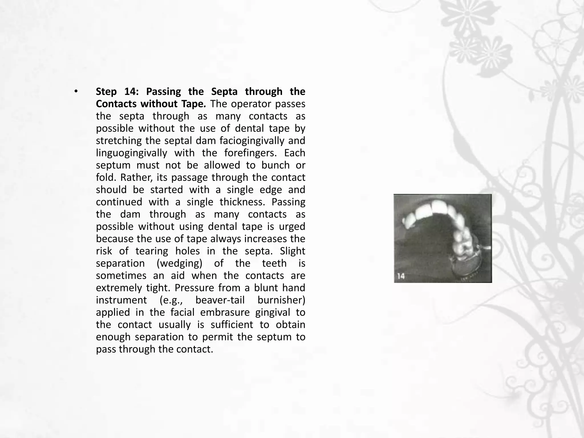 Isolation in Dentistry | PPTX