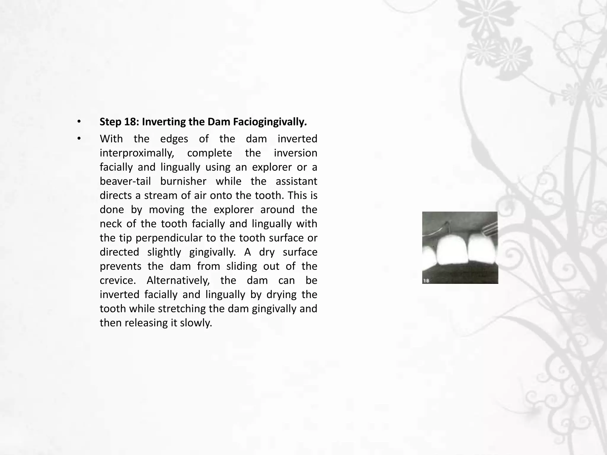 Isolation in Dentistry | PPTX