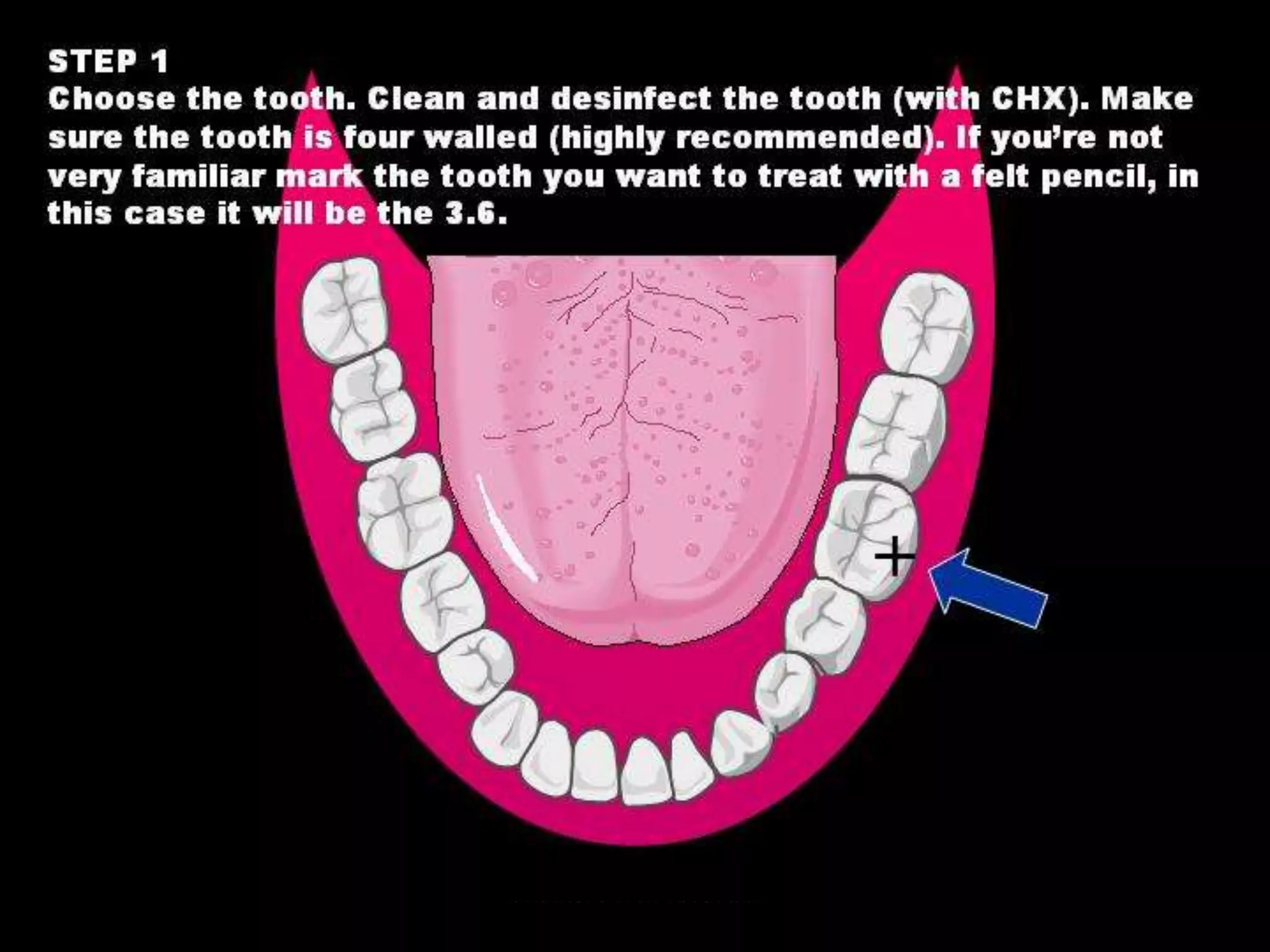 Isolation in Dentistry | PPTX