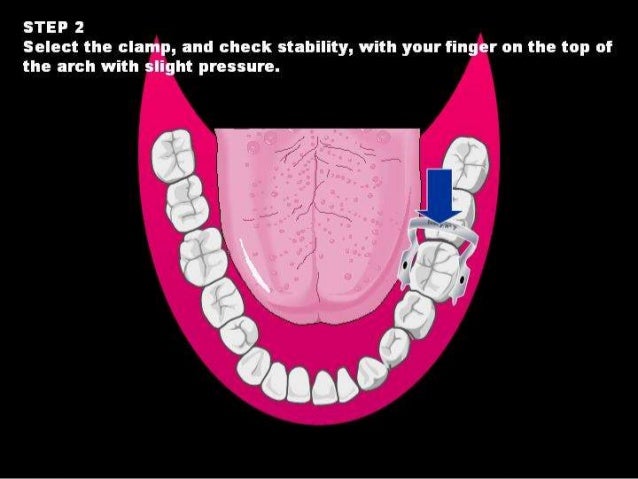 Isolation in Dentistry