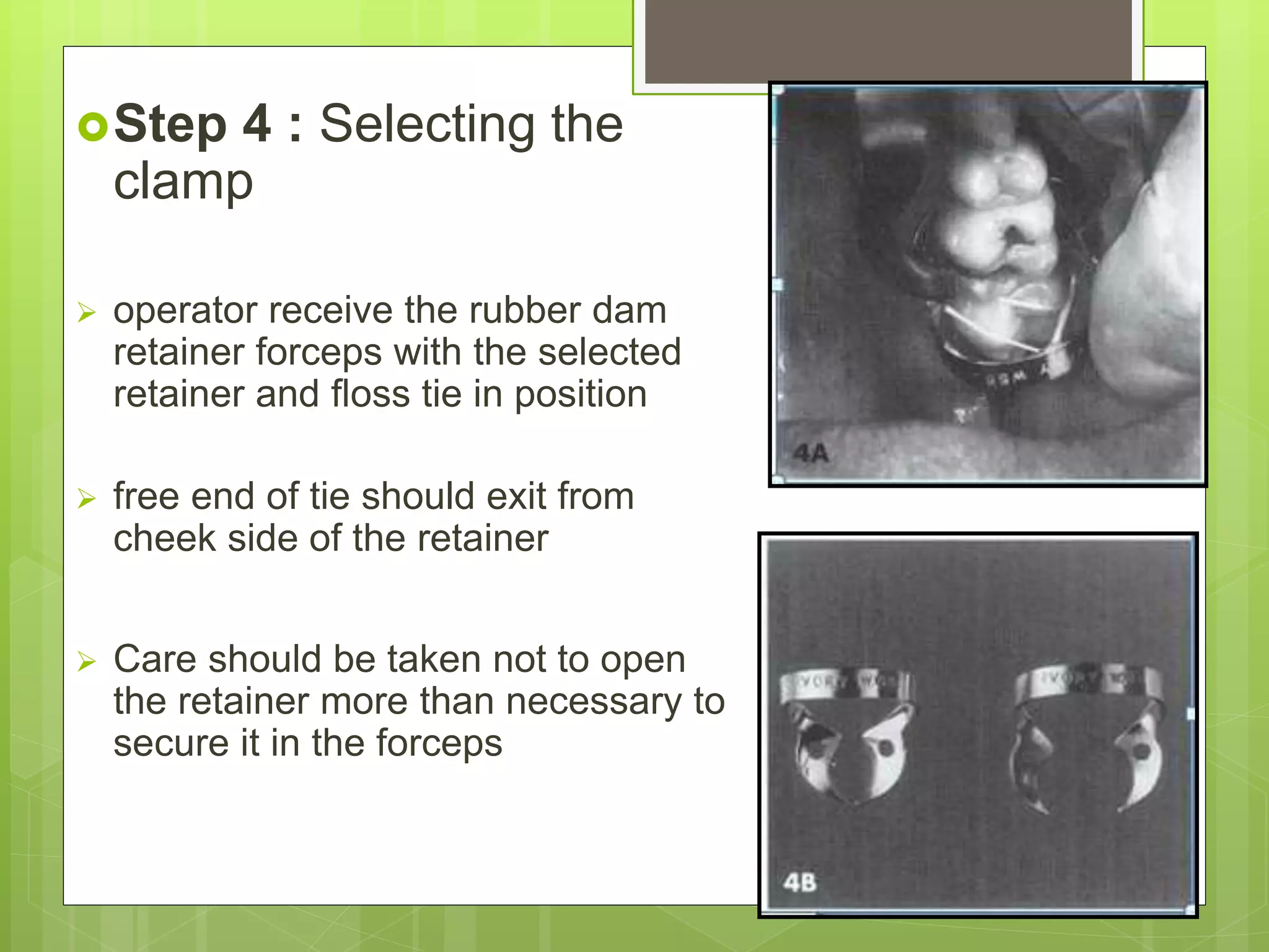 Isolation technique | PPTX