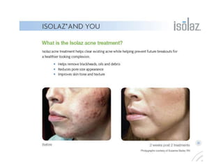 Isolaz for Acne - View Binder | PPTX