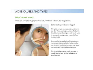 Isolaz for Acne - View Binder | PPTX