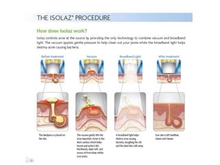 Isolaz for Acne - View Binder | PPTX