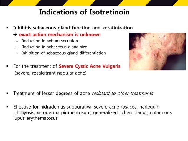Isotretinoin safety guideline | PDF | Pregnancy | Reproductive Health