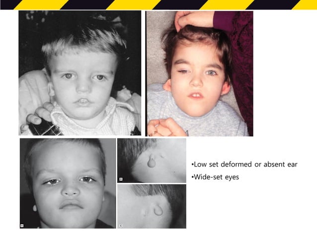 Isotretinoin safety guideline