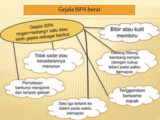 ISPA (Infeksi Saluran Pernapasan AKut) | PPTX