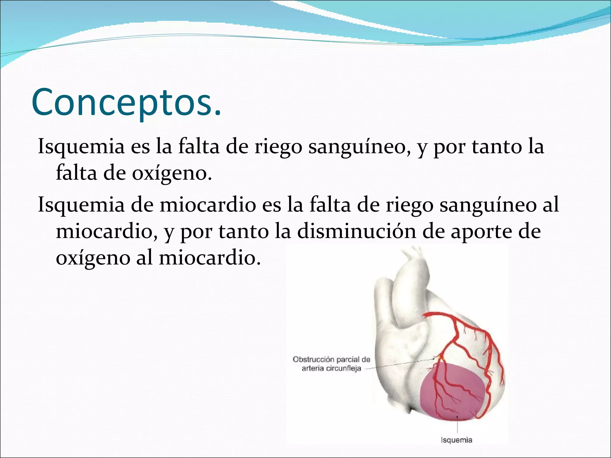 Isquemia de miocardio y marcapasos | PPT
