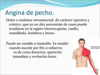 Isquemia de miocardio y marcapasos | PPT