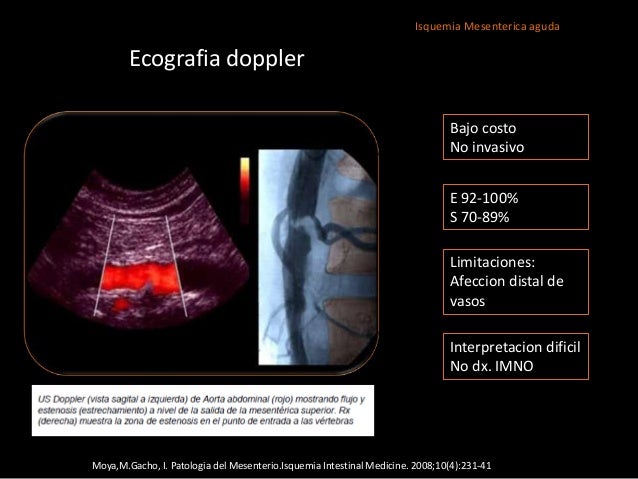 Isquemia intestinal juance (2)