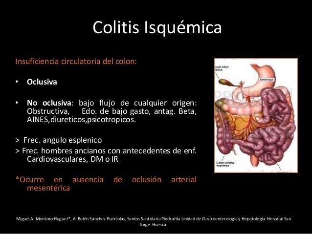 Isquemia intestinal juance (2)