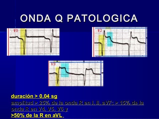 Isquemia,lesión y necrosis