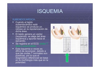 Isquemia, Lesion Y Necrosis | PDF