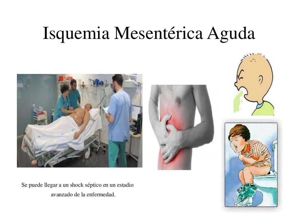 Isquemia