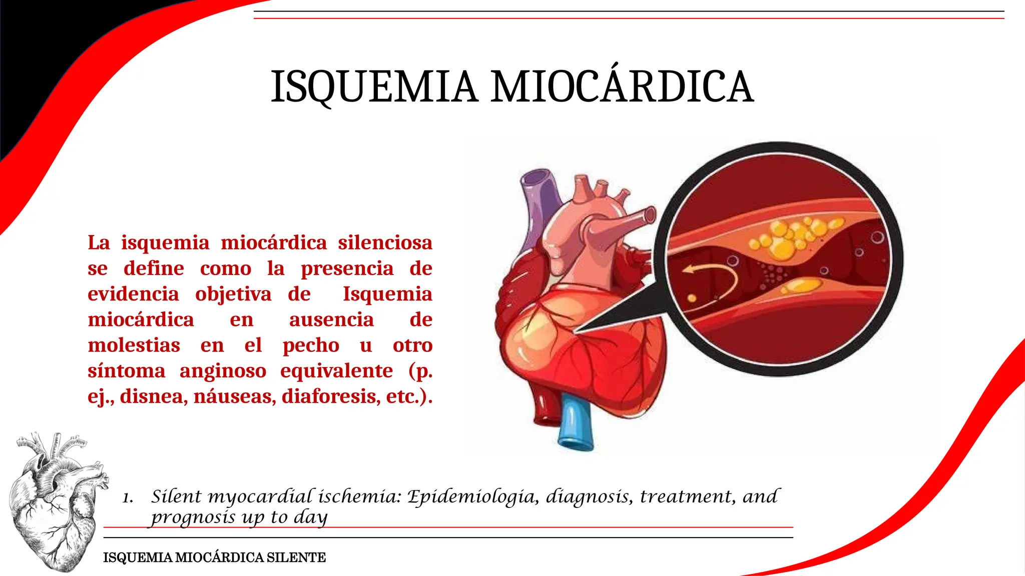 Isquemia Miocárdica Silente, generalidades | PPTX