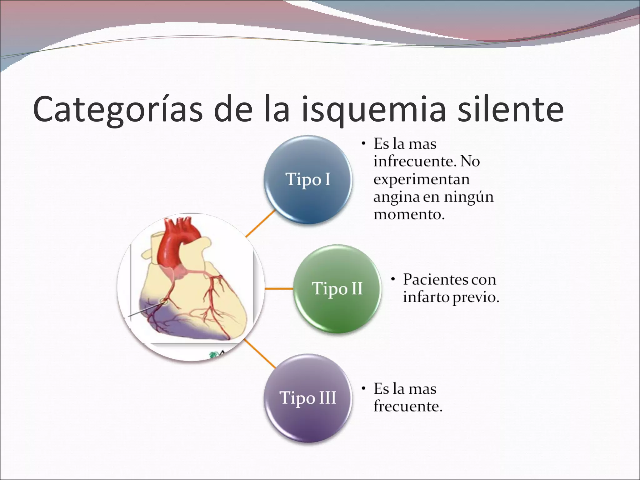 Isquemia silente | PPT