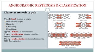 InStent Resetenosis: An Algorithmic Approach to Diagnosis and Treatment ...
