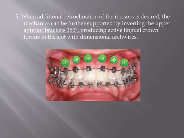 bracket positioning for smile arc protection | PPTX