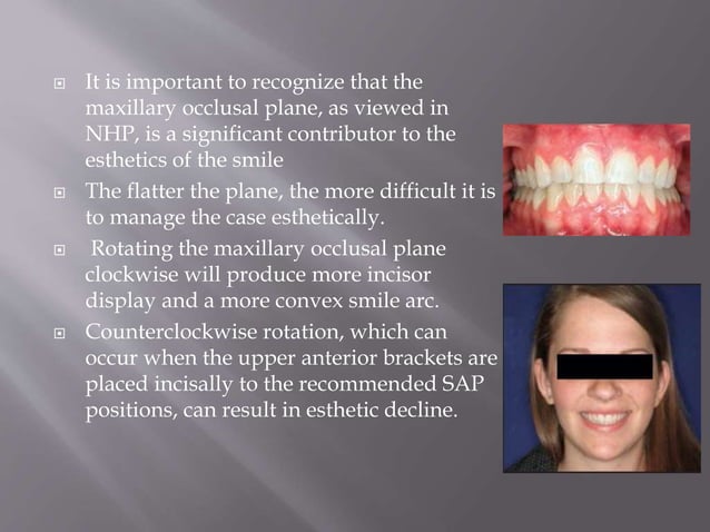 bracket positioning for smile arc protection | PPTX