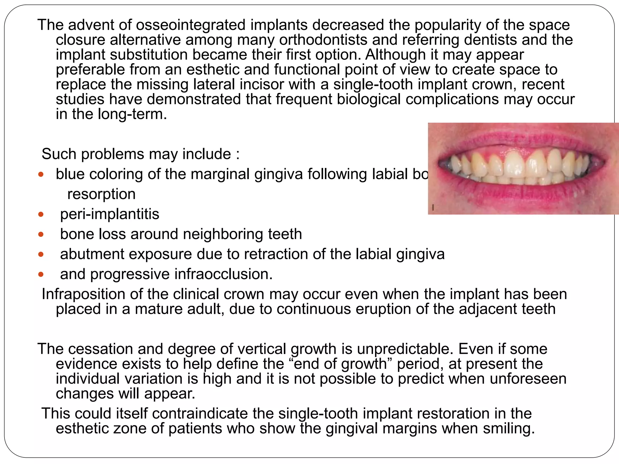 congenital missing maxillary lateral incisor(s) | PPTX