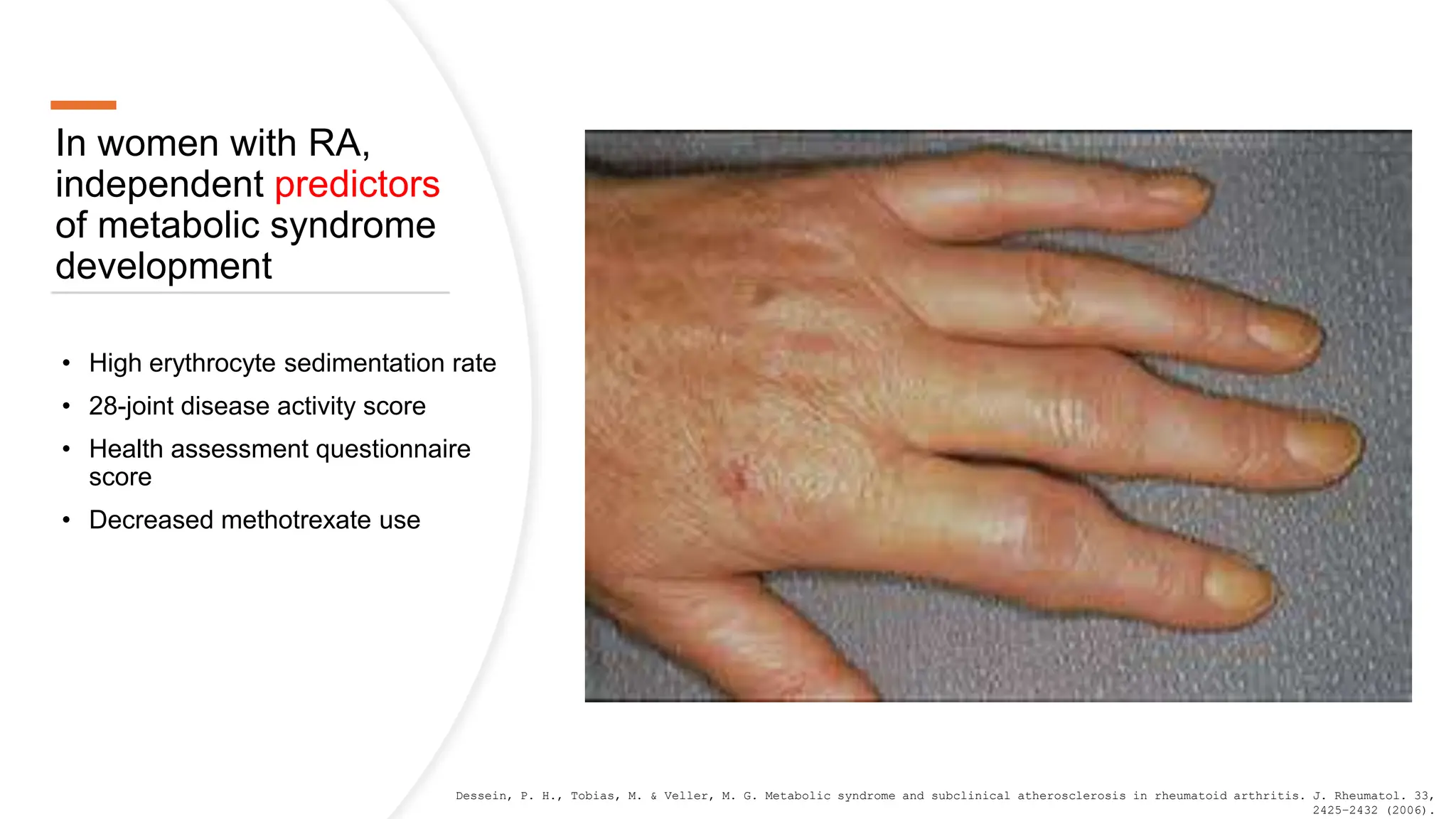 Is Rheumatoid Arthritis a Metabolic Disorder.pptx