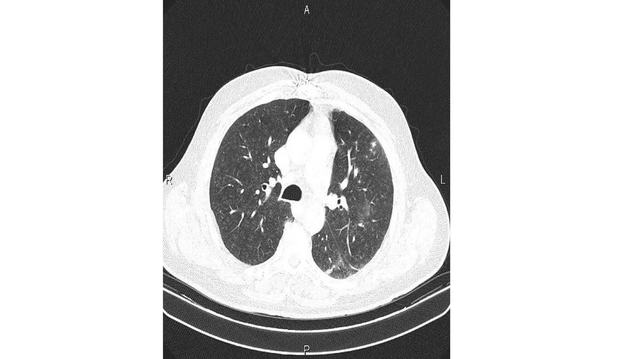 ISRRT PPT.pptx66666666666666666666666666666 | PPT