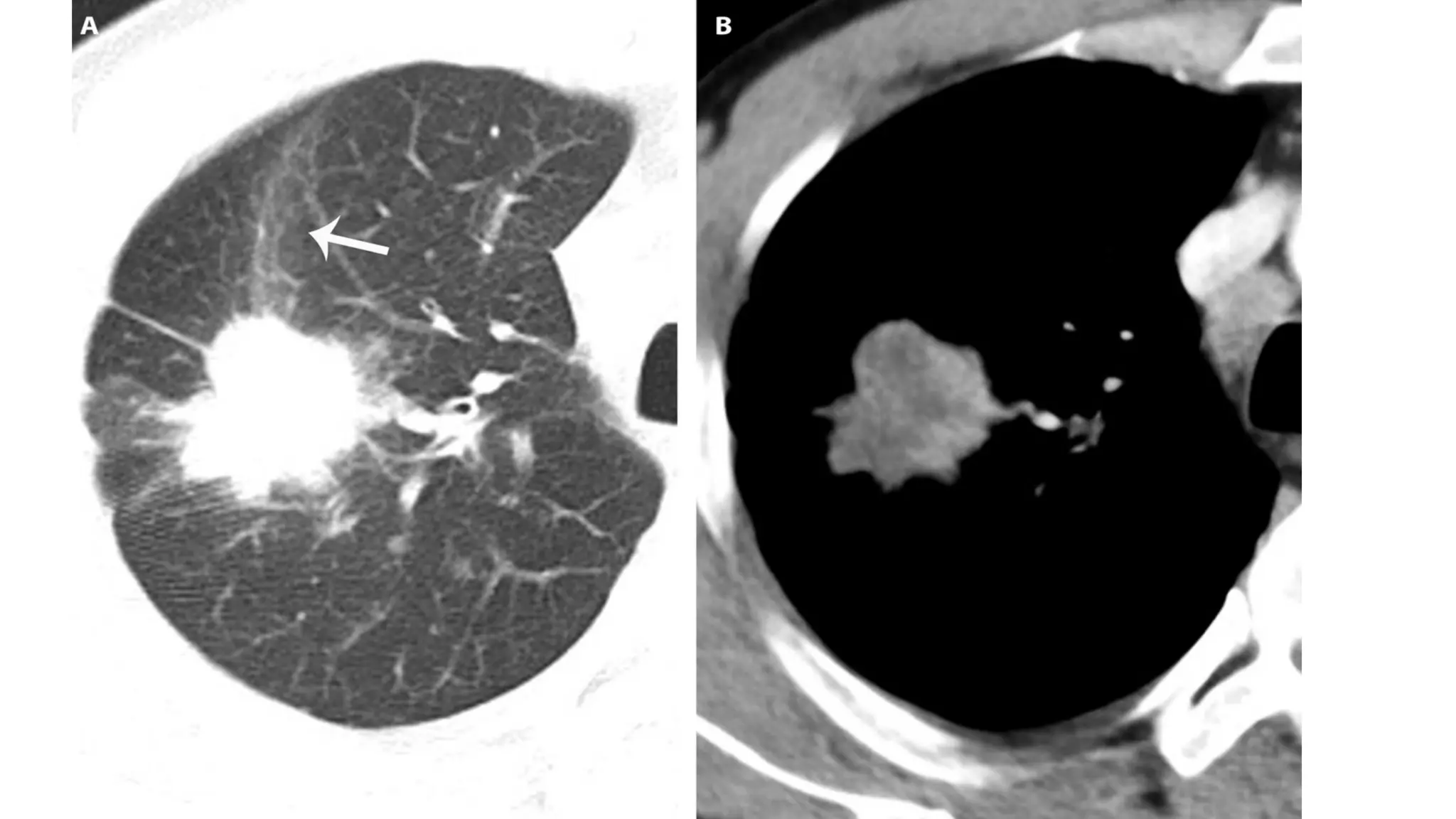 ISRRT PPT.pptx66666666666666666666666666666 | PPT