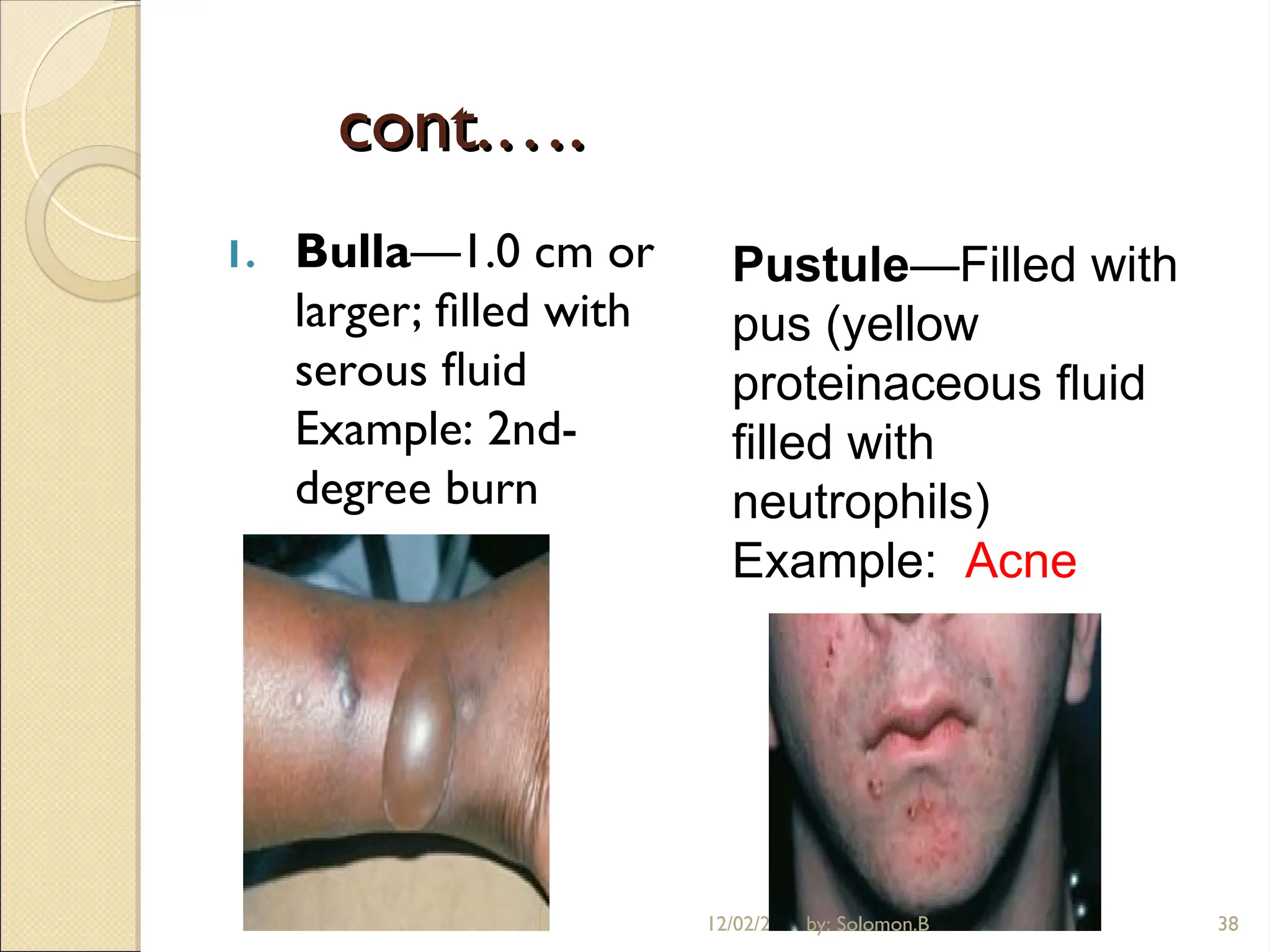 ISS.ppt for medical nursing students alone | PPT