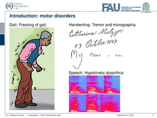 Multimodal i-vectors to Detect and Evaluate Parkinson’s Disease | PDF