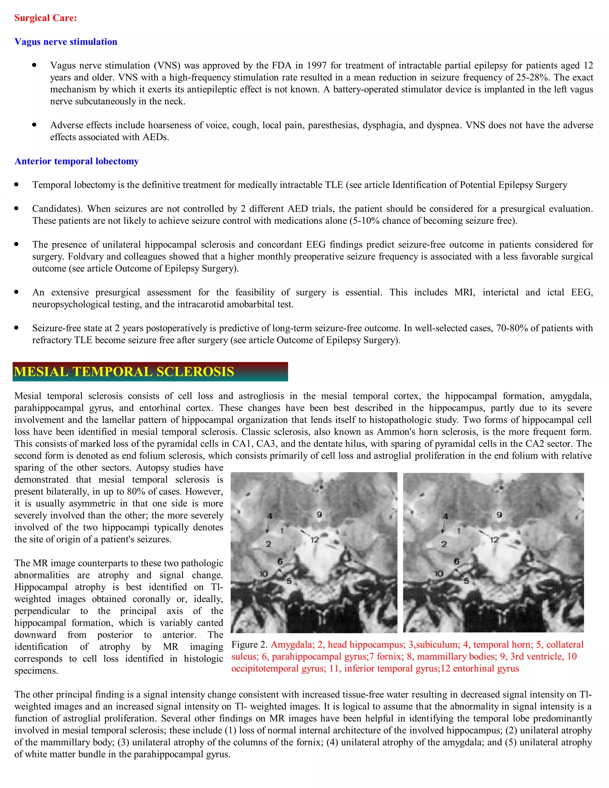 Issues in brainmapping...Temporal lobe epilepsy | PDF
