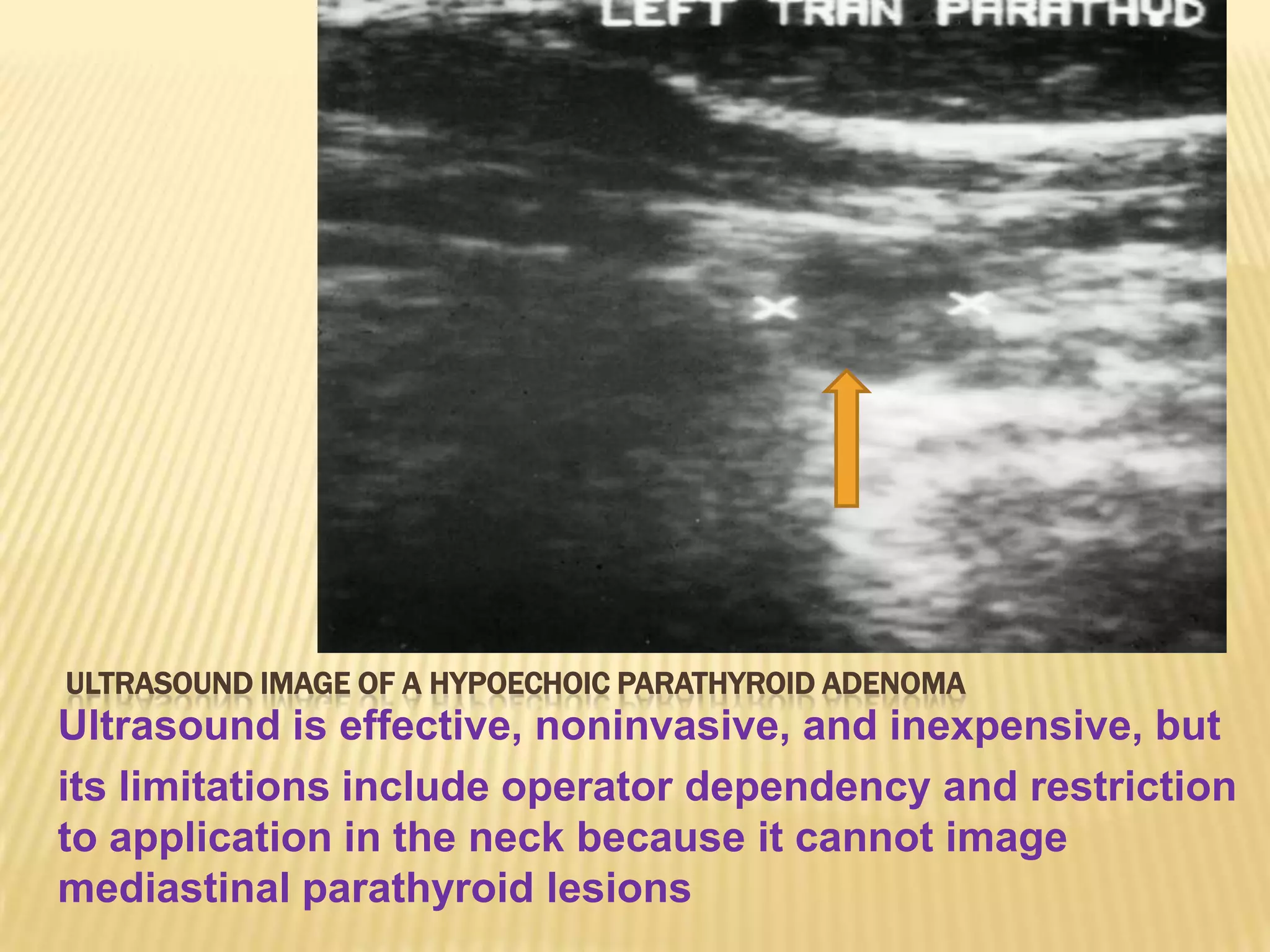 Issues in parathyroid surgery | PPTX