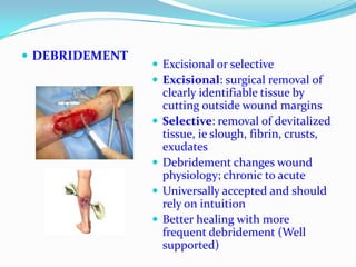 Infection of the chronic wound how to decide | PPT