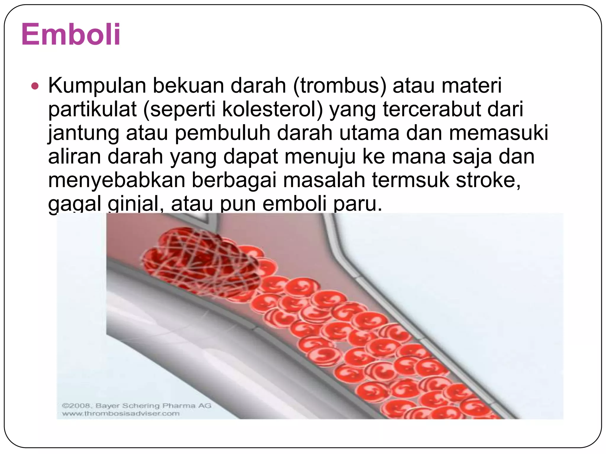 pembekuan darah | PPTX