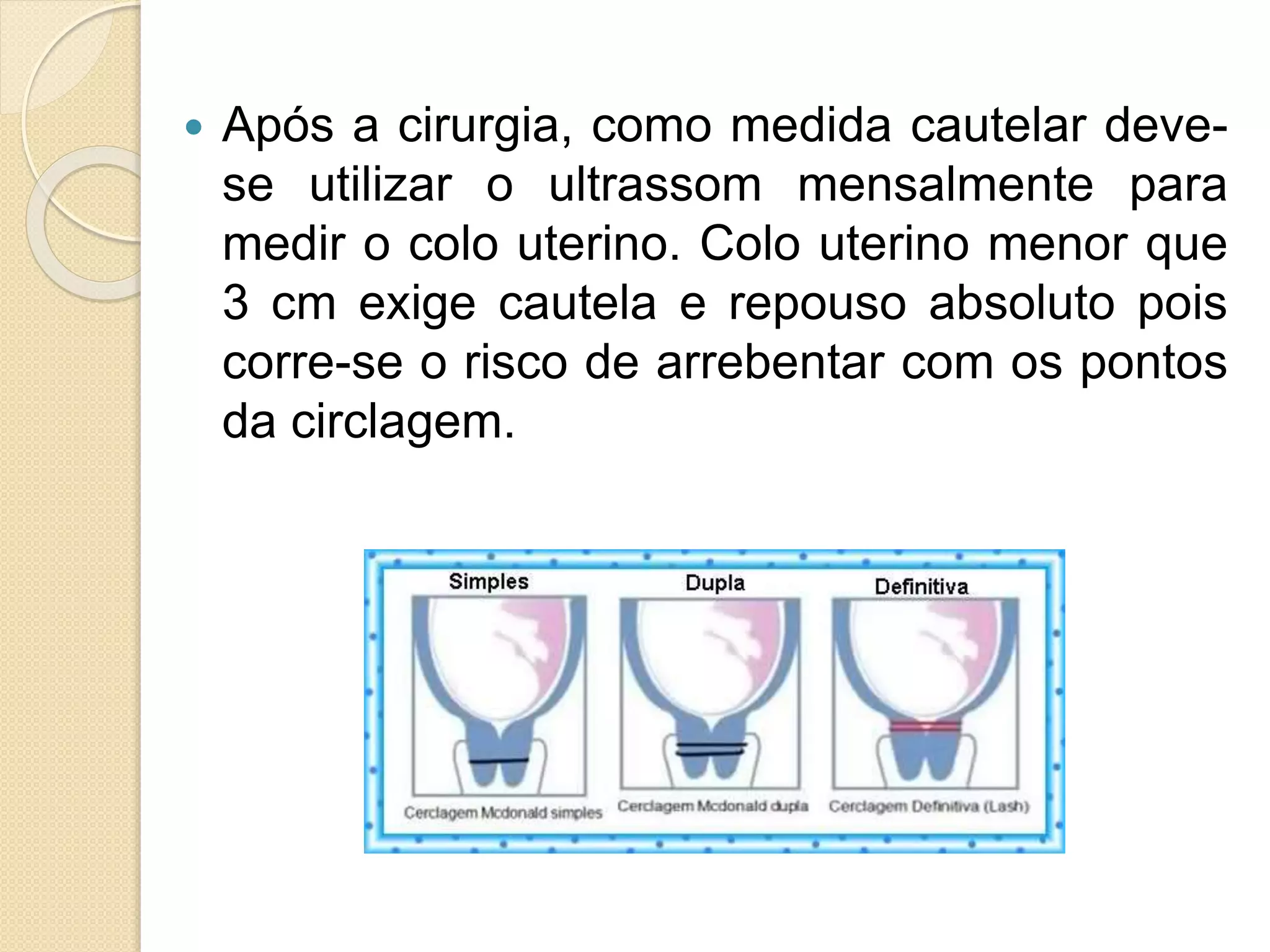 Deficiência Istmo-Cervical e Placenta Prévia | PPTX