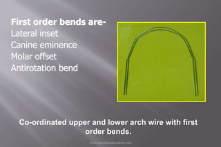 1ST, 2ND AND 3RD ORDER BENDS IN STANDARD EDGEWISE APPLIANCE SYSTEM ...