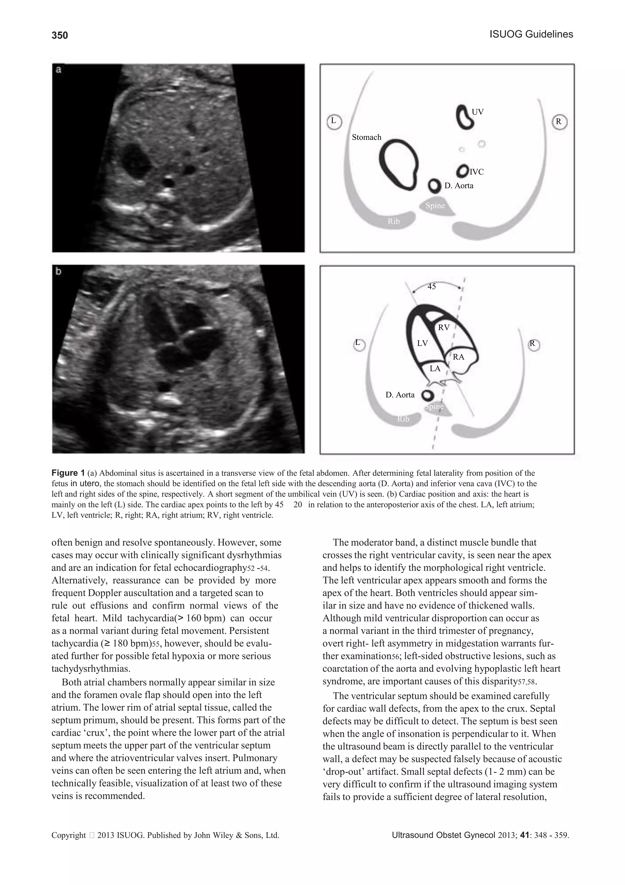 ISUOG Practice Guidelines (updated): sonographic screening examination ...