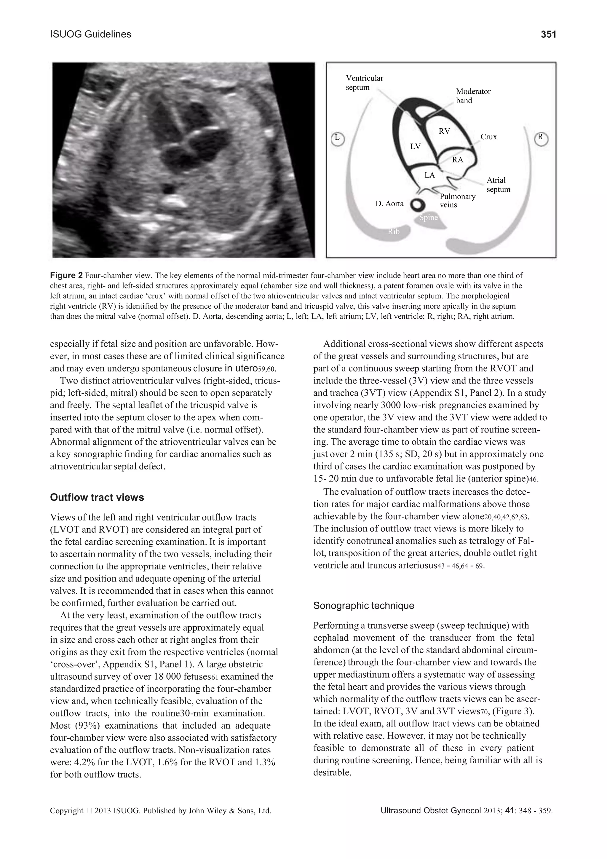 ISUOG Practice Guidelines (updated): sonographic screening examination ...