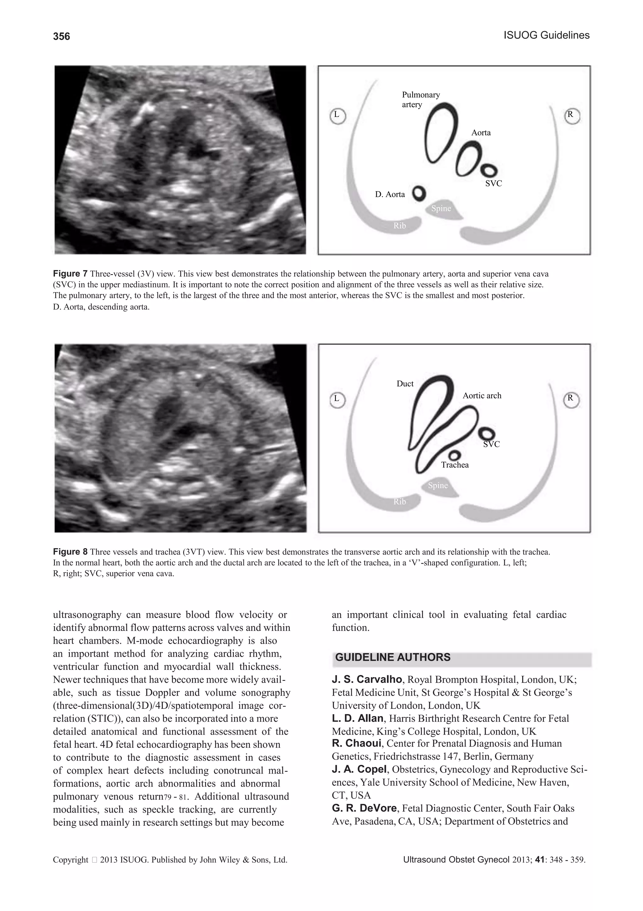 ISUOG Practice Guidelines (updated): sonographic screening examination ...